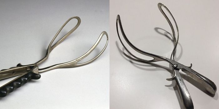 Gunakan Metode Forsep Saat Persalinan, Kepala Bayi ini Sampai Terputus