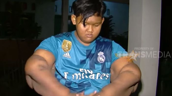 Turun 91 Kg, Inilah 3 Kunci Sukses Arya Permana yang Berhasil ...
