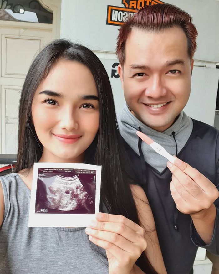 Hamil Anak Kedua, Feby Marcelia dan Revand Narya Pamer Foto USG