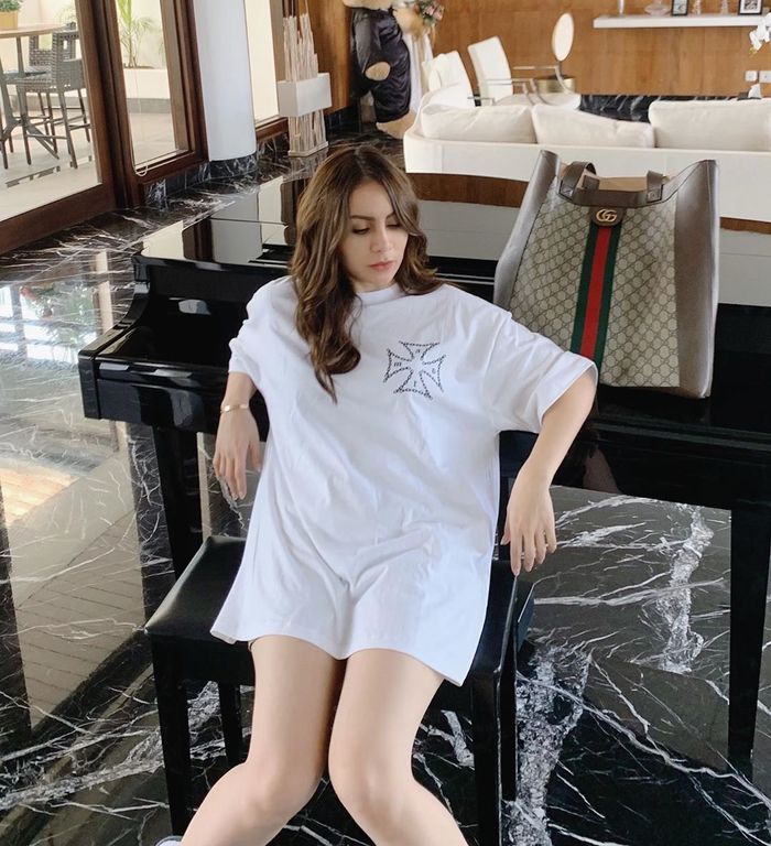 Kayak Nggak Pakai Celana Saat Kenakan Oversized T-Shirt, Kondisi Kaki Momo Geisha Justru Bikin ...