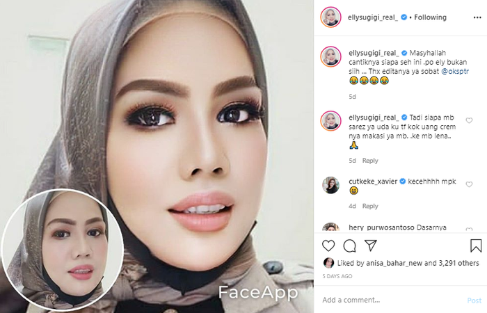 Potret Wajah Elly Sugigi Pasca Operasi Plastik, Makin Cantik dan Dipuji ... Potret Wajah Elly Sugigi Pasca Operasi Plastik, Makin Cantik dan Dipuji ...