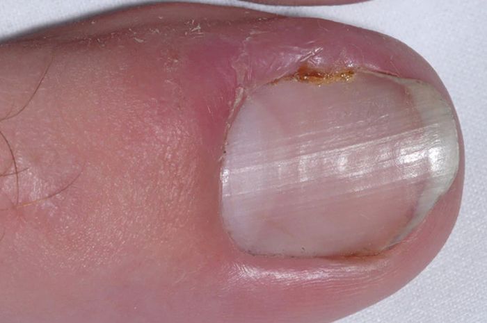 10 Tanda yang Muncul Di Kaki Ini Bisa Jadi Pertanda Penyakit Berbahaya ... 10 Tanda yang Muncul Di Kaki Ini Bisa Jadi Pertanda Penyakit Berbahaya ...