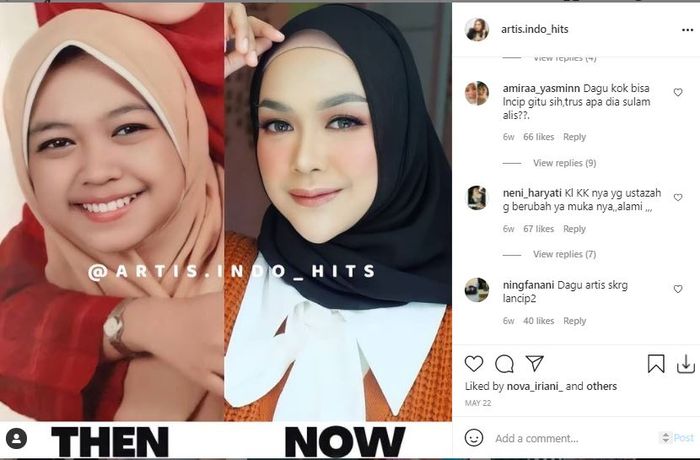 Transformasi Ria Ricis Dulu dan Sekarang dari Chubby Hingga Tirus ...