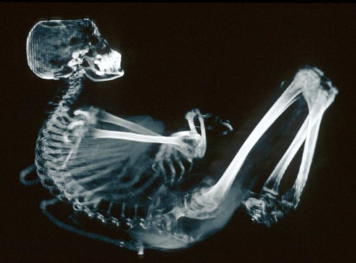 Juanita, Mumi Gadis Es Inca yang Tubuhnya Dikurbankan di Gunung Ampato ...