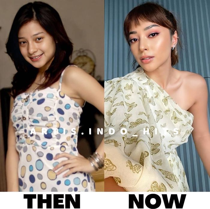 Tampilan Cantik Nikita Willy Sebelum Dan Sesudah Filler Dagu Lebih