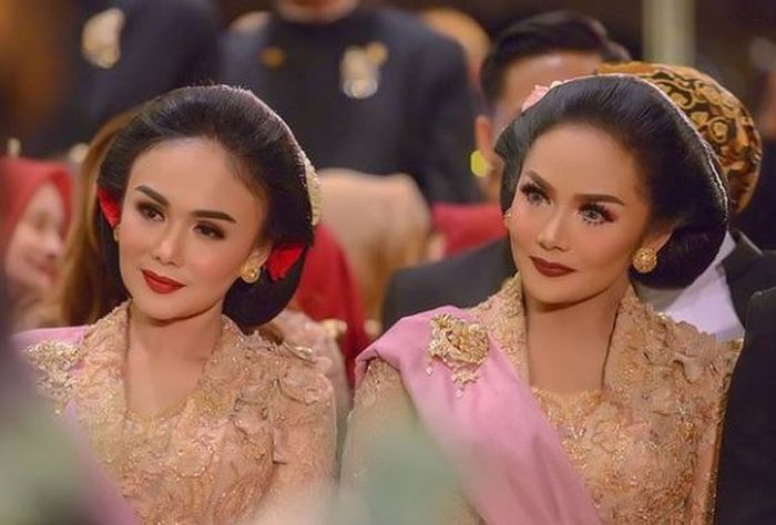 Cantik Kinyis-kinyis Tanpa Sentuhan Jarum Klinik, Yuni Shara dan ... Cantik Kinyis-kinyis Tanpa Sentuhan Jarum Klinik, Yuni Shara dan ...