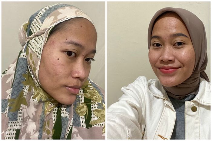 Jurnal Kulit Sensitif Ananda Amelia: Pentingnya Menemukan Basic ...