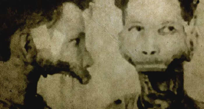 Apa Itu Radithor yang Bikin Sosok Eben Byers Alami Rahang Lepas? - Intisari