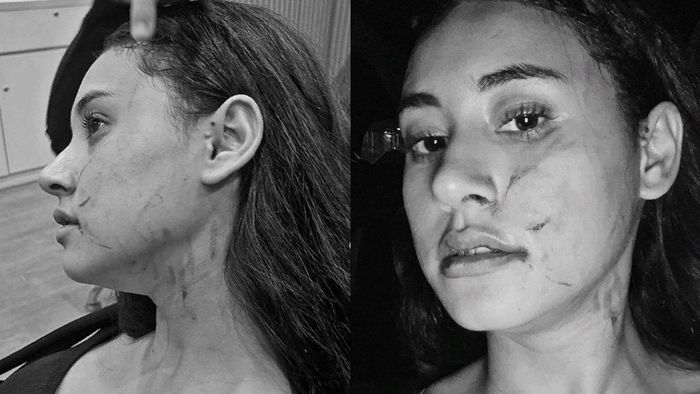 Afifah Riyad Dipukuli Mantan Pacar Suaminya hingga Babak Belur, Sang ...