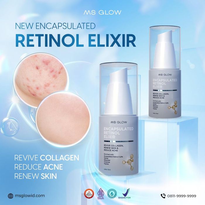 5 Rekomendasi Retinol untuk Jerawat Terbaik 2024 di Bawah Rp 200 Ribu ...