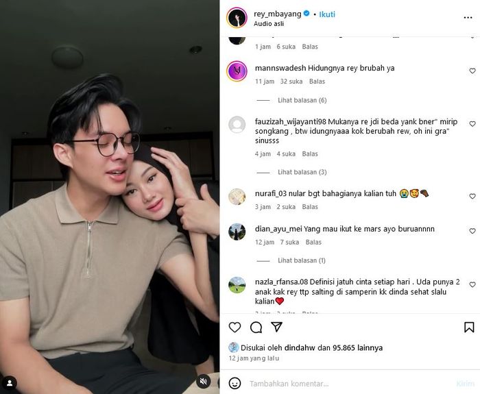 Wajah Rey Mbayang dan Dinda Hauw Dituding Oplas Saat Pamer Kemesraan, Hidungnya Beda? - Stylo