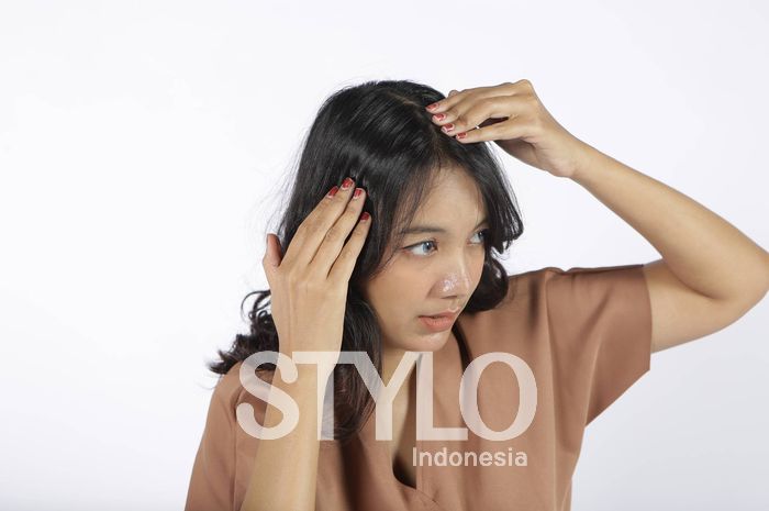 Penyebab Ketombe Basah dan Bau di Kepala, Keramas Pakai Sampo Apa? - Stylo
