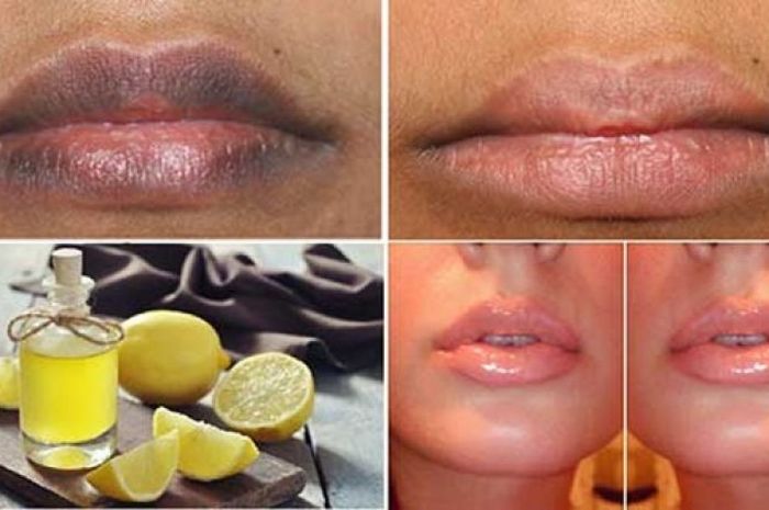 Hanya dalam 10 Menit, Bibir Jadi Pink Alami dengan Bahan Rumahan ini - Nakita