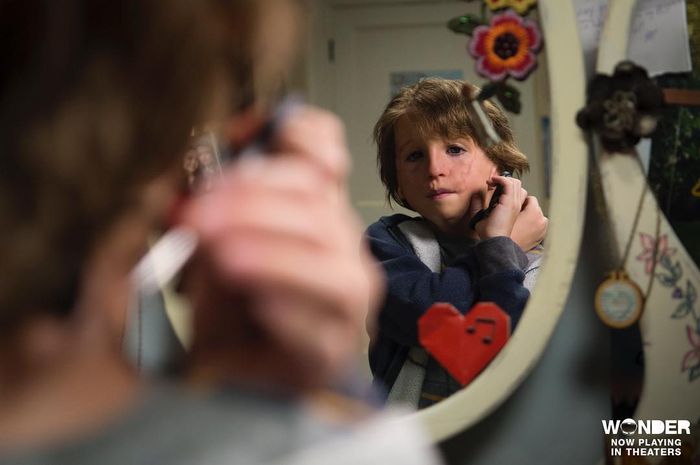 Perankan Karakter Anak Buruk Rupa di Film Wonder, Inilah Foto Asli ...