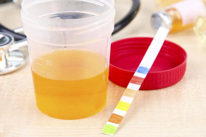 Kenali Tanda 4 Penyakit Kronis Lewat Urine yang Sering Berbusa