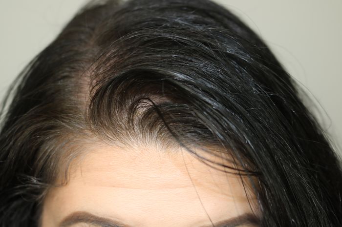 Beginilah Tips Mengatasi Rambut Lepek Tanpa Harus Keramas, Perhatikan ...