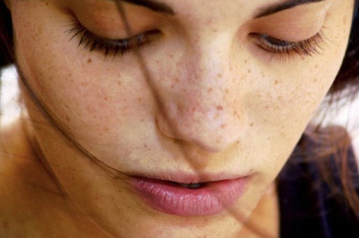 Kenali, Ini 4 Jenis Flek pada Wajah! Bisa Dihilangkan Enggak Ya ...