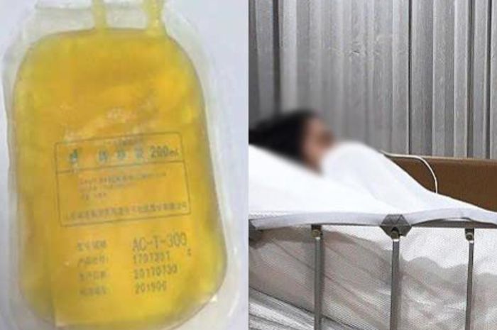 Mengerikan! Darah Wanita Ini Berubah Jadi Kuning Karena Sering Makan ...