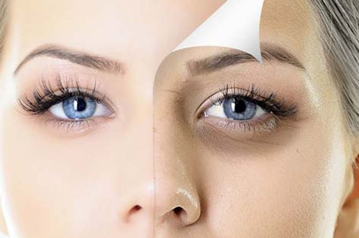 Ini Alasan Kita Punya Mata Panda dan Cara Cepat Menghilangkannya ...