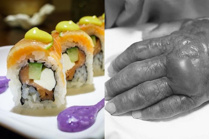 Gara-gara Makan Sushi, Tangan Pria Ini Membusuk dan Harus Diamputasi ... Gara-gara Makan Sushi, Tangan Pria Ini Membusuk dan Harus Diamputasi ...