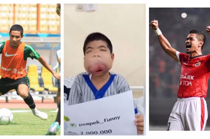 Arga Niko Saputra, Penderita Tumor Rahang yang Bermimpi Bertemu Evan ... Arga Niko Saputra, Penderita Tumor Rahang yang Bermimpi Bertemu Evan ...