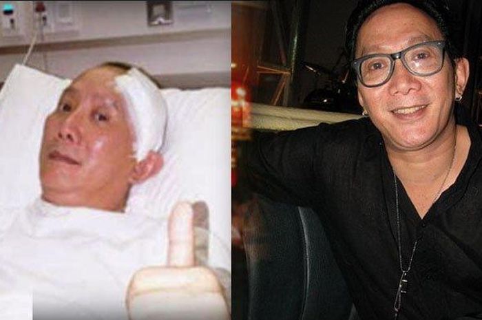 Tata Dado Hingga Robby Tumewu Meninggal Karena Stroke, 5 Jenis Makanan ...