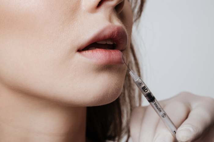 Filler Bibir Ala Jessica Iskandar: Manfaat, Risiko, dan Kisaran Harga ...