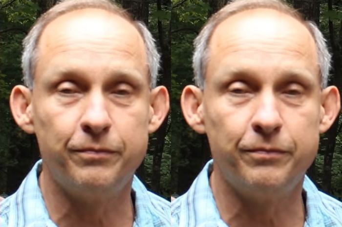 David Linglei, Pasien Leukemia yang Dinyatakan Sembuh Tanpa Kemoterapi ...