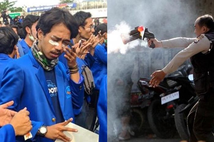 Penangkal Gas Air Mata Saat Demo UU Cipta Kerja Jangan Pakai Pasta Gigi, Bahaya! - Grid Health
