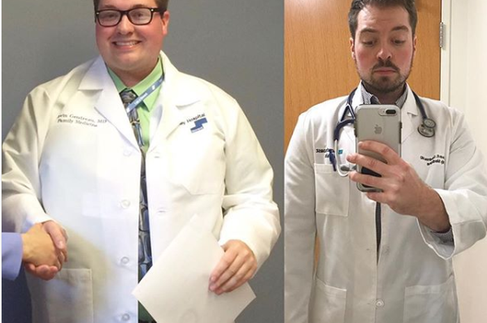 Berhasil Turunkan Berat Badan Hingga 46 Kg, Dokter Ini Justru Mengaku ...