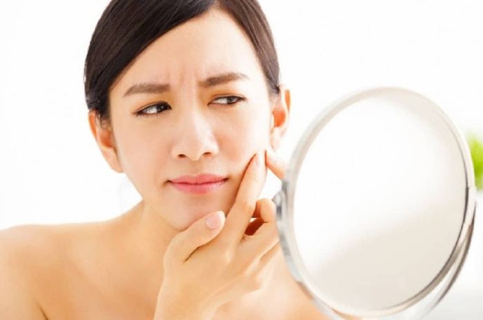 Ciri-ciri Purging Pada Wajah Berbeda dengan Iritasi, Ini Kata Ahli! - Stylo