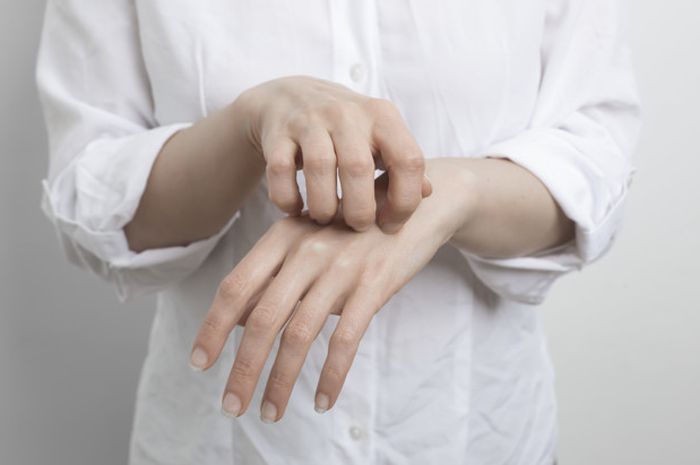 Ada Gejala Baru Corona: Kulit Jadi Kemerahan dan Gatal-Gatal - Hai