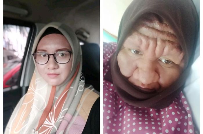 Viral Kisah Wanita Cantik Yang Wajahnya Berubah Drastis Saat Hamil Ke 3 Berubah Seperti Nenek