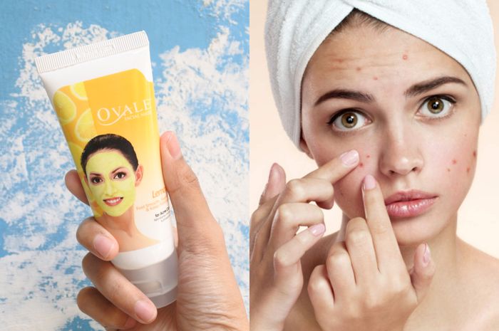Manfaat Masker Ovale Lemon untuk Atasi Peradangan dan Jerawat, Mau ...