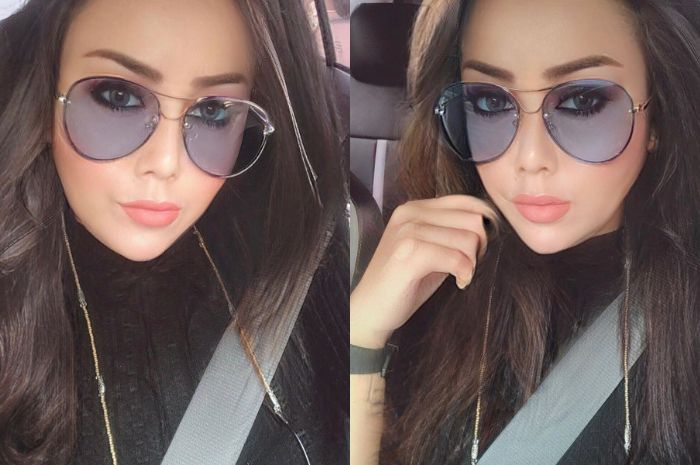 Mengerikan! Artis ini Jadi Korban Malpraktik Klinik Kecantikan Hingga ...