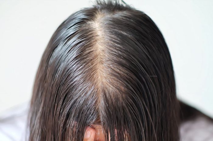 4 Cara Ini Ampuh Bikin Rambut Tumbuh Secara Alami. Cobain, Deh ...