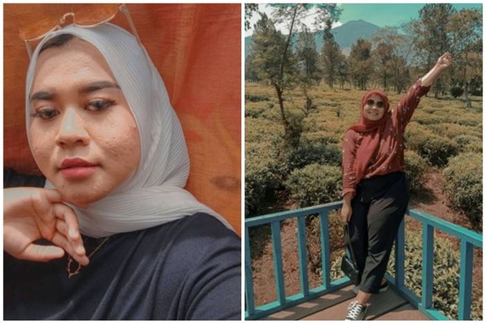 Clarisa Aisyah Insani: Perempuan Tangguh Sang Acne Fighter Penyintas ...