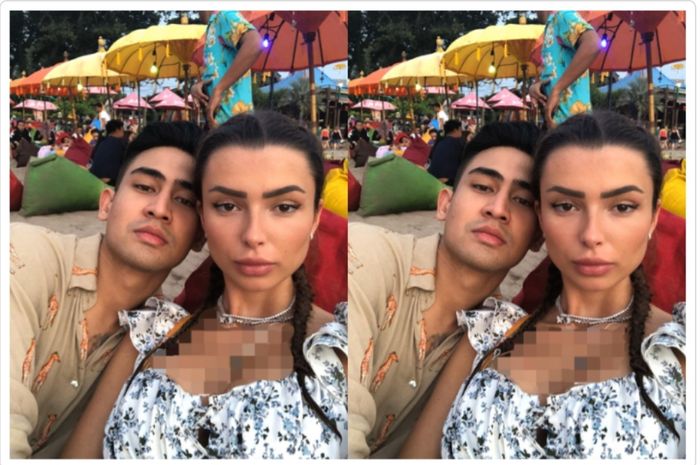 Pacaran 3 Tahun dengan Bule London, Axel Matthew Harus Putus di Tengah ...