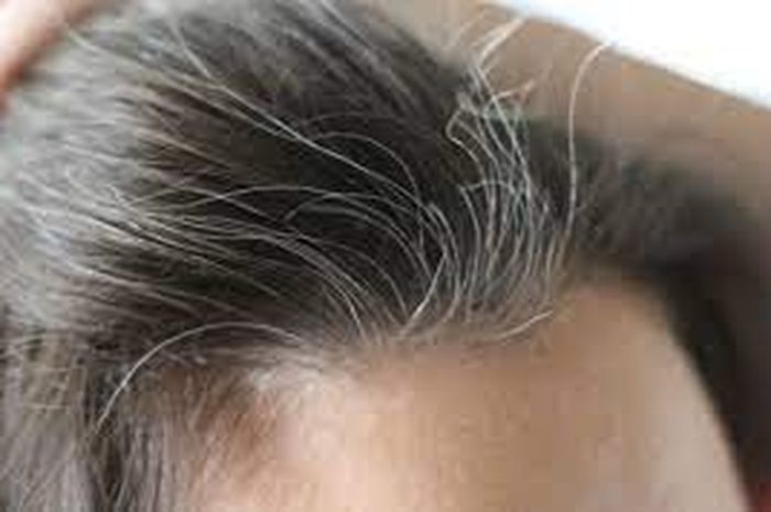 Kawula Muda Wajib Tahu! Ternyata Inilah Penyebab Uban Bisa Tumbuh di Usia Muda, Simak Cara Mudah ...