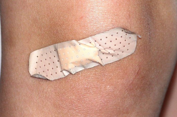 Pertolongan Pertama pada Luka Lecet, Agar Tidak Membekas pada Kulit - Bobo