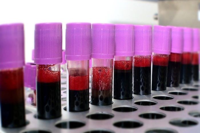 Mengapa Warna Darah Ada yang Merah Cerah dan Merah Tua? - Adjar