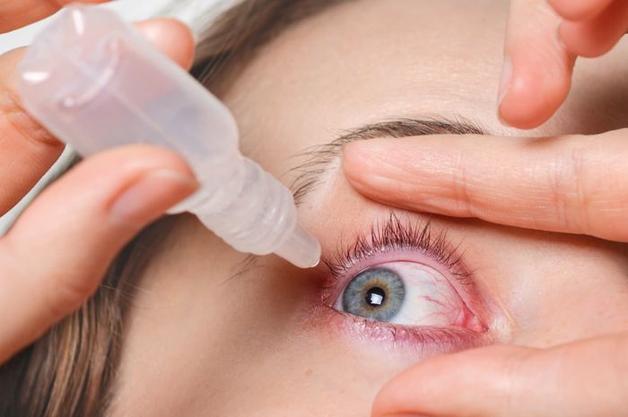 Sering Alami Mata Gatal? Ini 5 Hal yang Bisa Jadi Penyebabnya dan Cara ...