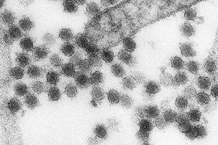 Reproduksi Virus: Tahapan Daur Litik dan Daur Lisogenik - Adjar