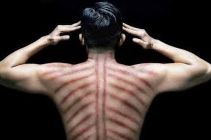 Jadi Cara Masyarakat Indonesia untuk Hilangkan Masuk Angin, Waspada! 5 ...