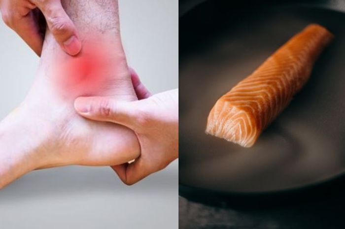 Ucapkan Selamat Tinggal pada Asam Urat yang Sering Kambuh, Mulai Hari ...