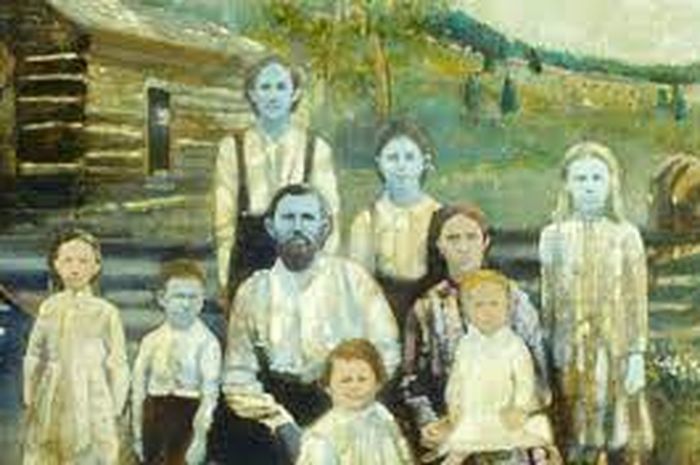 Misteri di Balik Orang-orang Berkulit Biru di Kentucky yang Mirip dalam ...