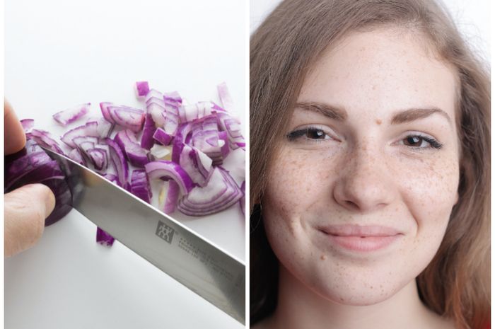 Flek Hitam hingga Jerawat Ternyata Bisa Dihilangkan Cuma Pakai Bawang ...