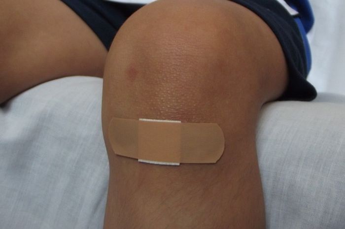 Supaya Enggak Membekas, Begini Cara Menangani Luka Lecet, Sudah Tahu ...