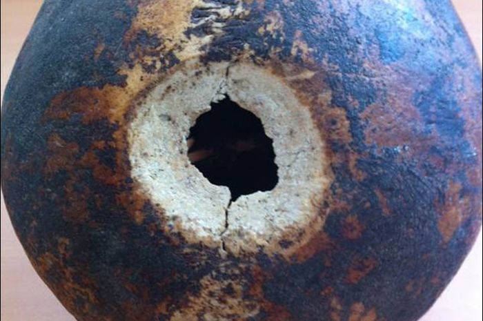 Trepanasi, Teknik Pengeboran Kepala dari Suku Siberia Ini Bikin Ngeri ...