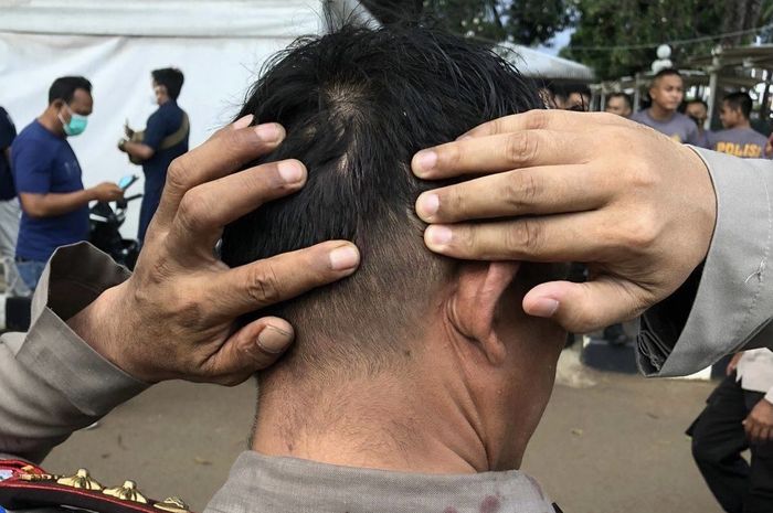 Alami Penggumpalan Darah di Kepala, Ini Foto Luka AKBP Dermawan yang Dipukul Anggota Pemuda ...
